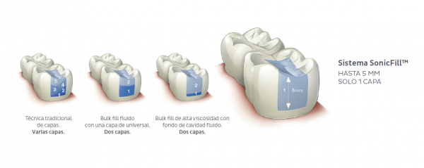 COMPOSITE UNIDOSIS SONICFILL 2 | Blasdent